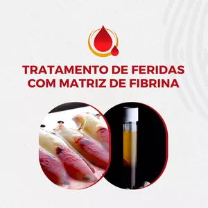 Matriz de Fibrina - Sandriellen Costa Silva | Hotmart