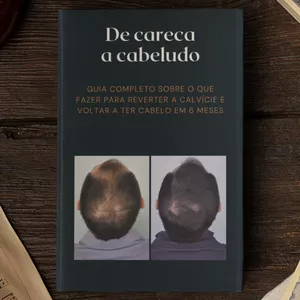 De Careca a Cabeludo - Guia completo sobre o que fazer para reverte...