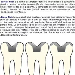 PROTESE FIXA - EL TREINADOR CURSO | Hotmart